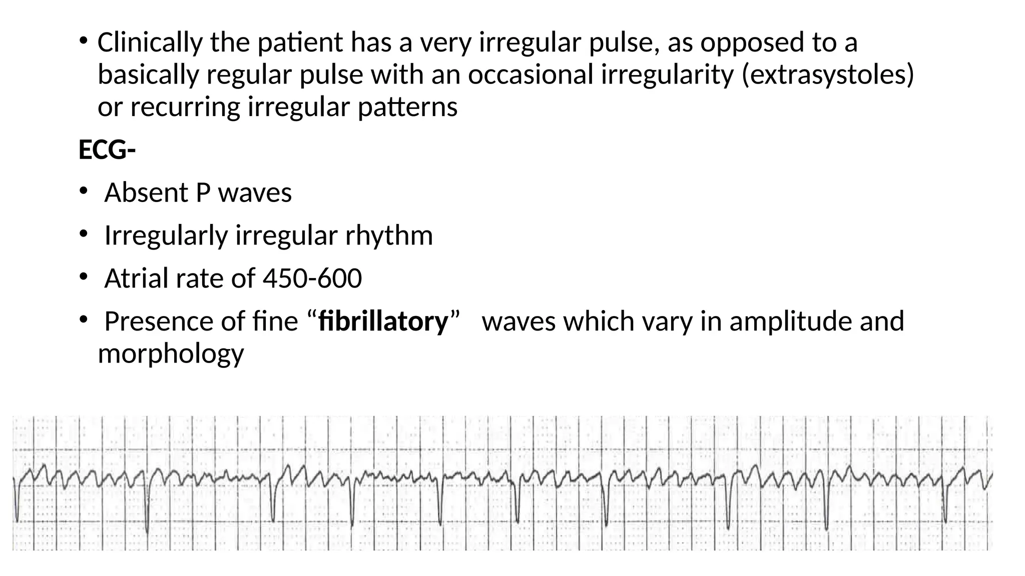 Cardiccccac Arrhythmias [Autosaved].pptx