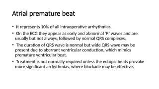Cardiccccac Arrhythmias [Autosaved].pptx
