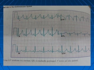 pediatrics.Cardiac arrhythmias.(dr.hader) | PPT