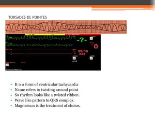 Cardiac arrhythmias originating in the ventricles | PPTX