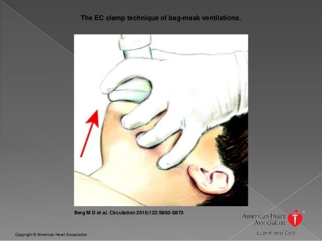 Cardiac arrest and CPR