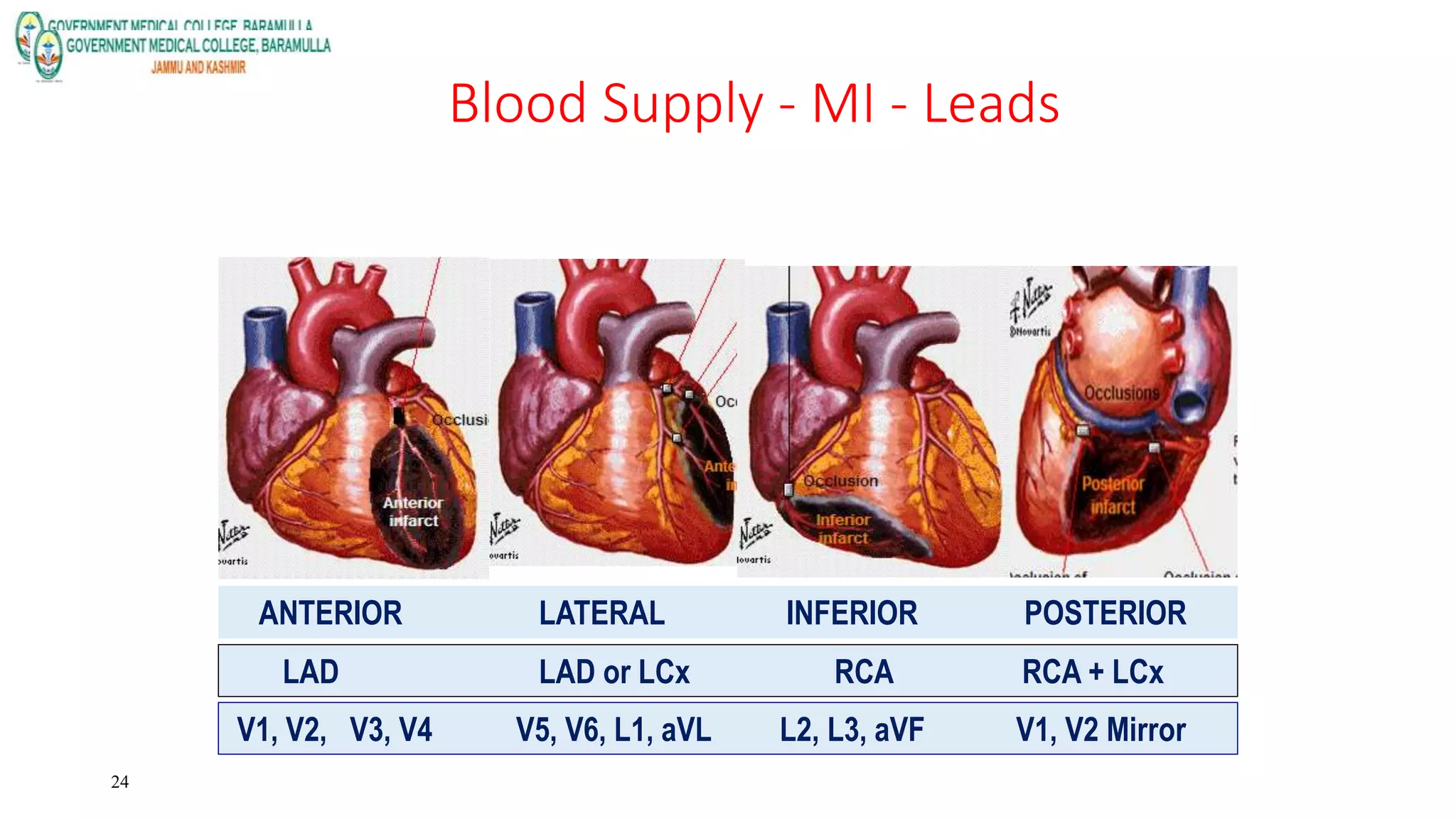 CARDIAC ARRTHYMIAs PART 2 BY DR. QAZI IMTIAZ RASOOL | PPT