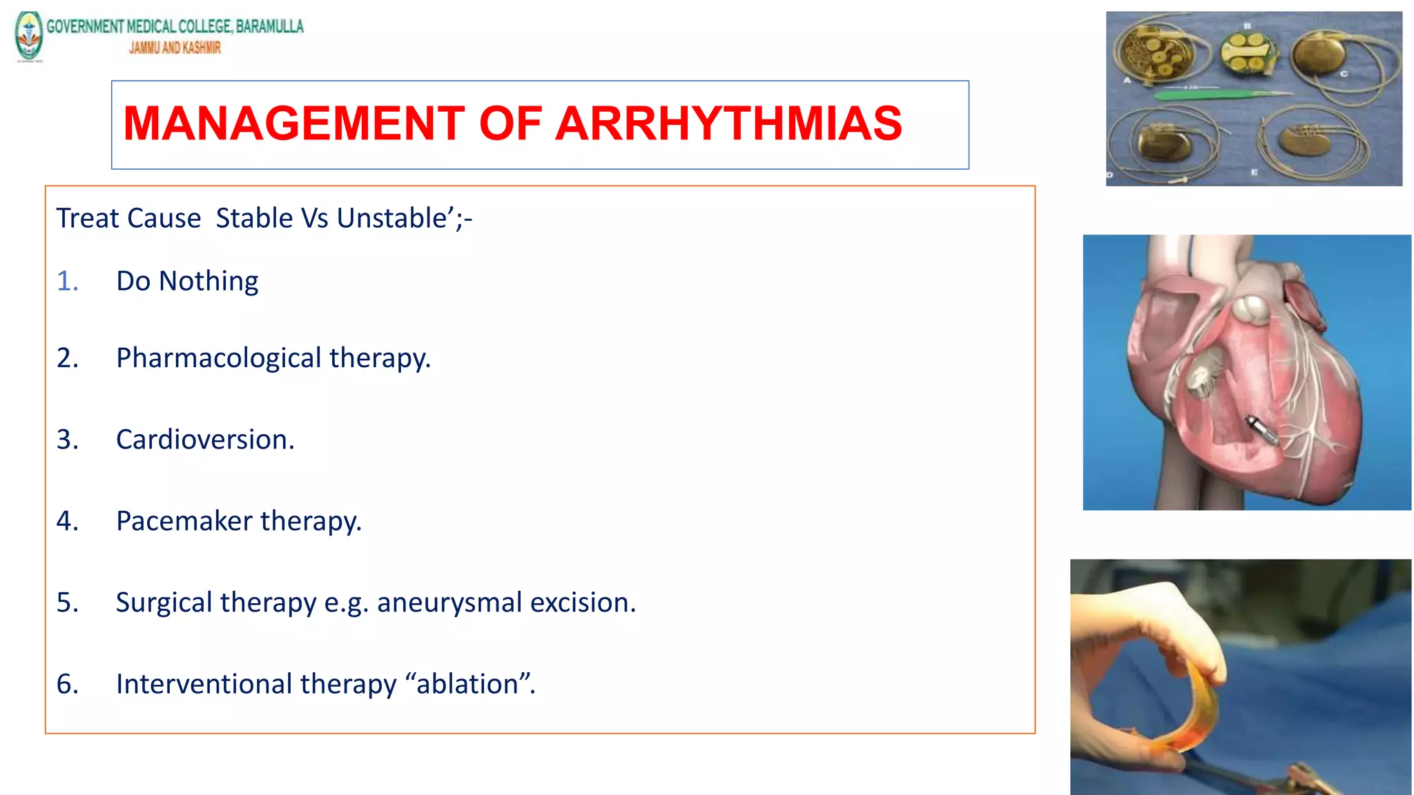 CARDIAC ARRTHYMIAs PART 2 BY DR. QAZI IMTIAZ RASOOL | PPT