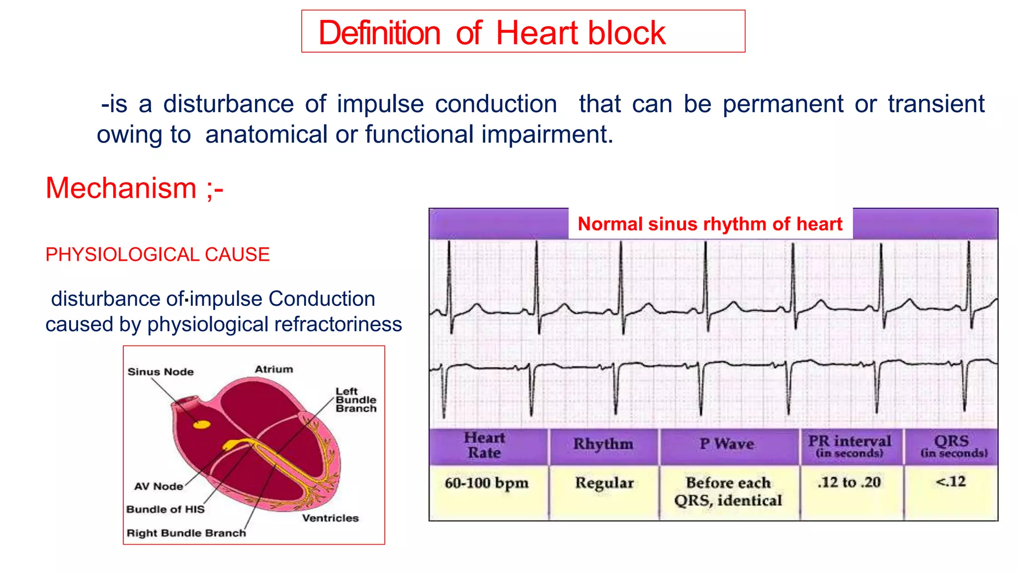 CARDIAC ARRTHYMIAs PART 2 BY DR. QAZI IMTIAZ RASOOL | PPT