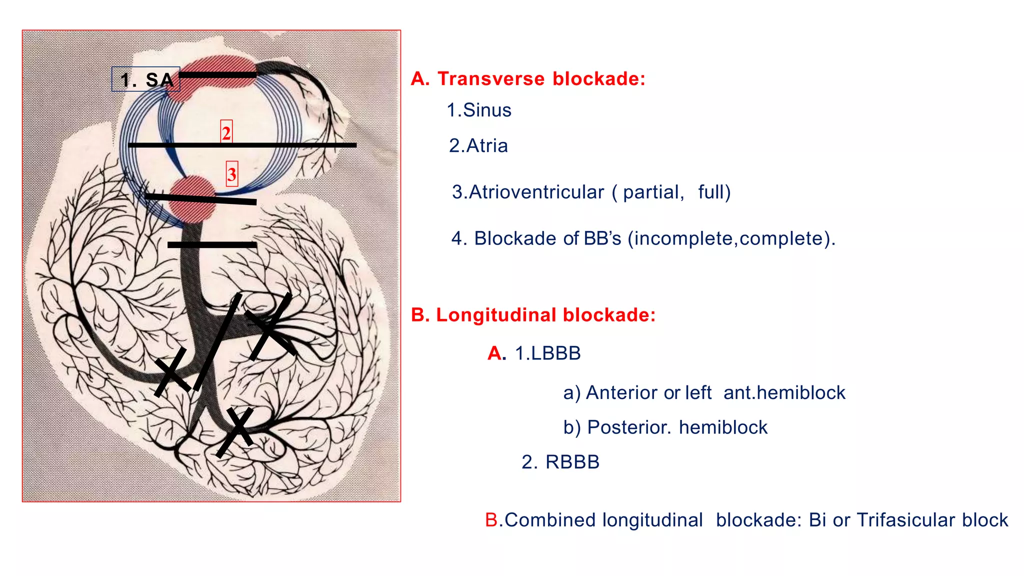 CARDIAC ARRTHYMIAs PART 2 BY DR. QAZI IMTIAZ RASOOL | PPT
