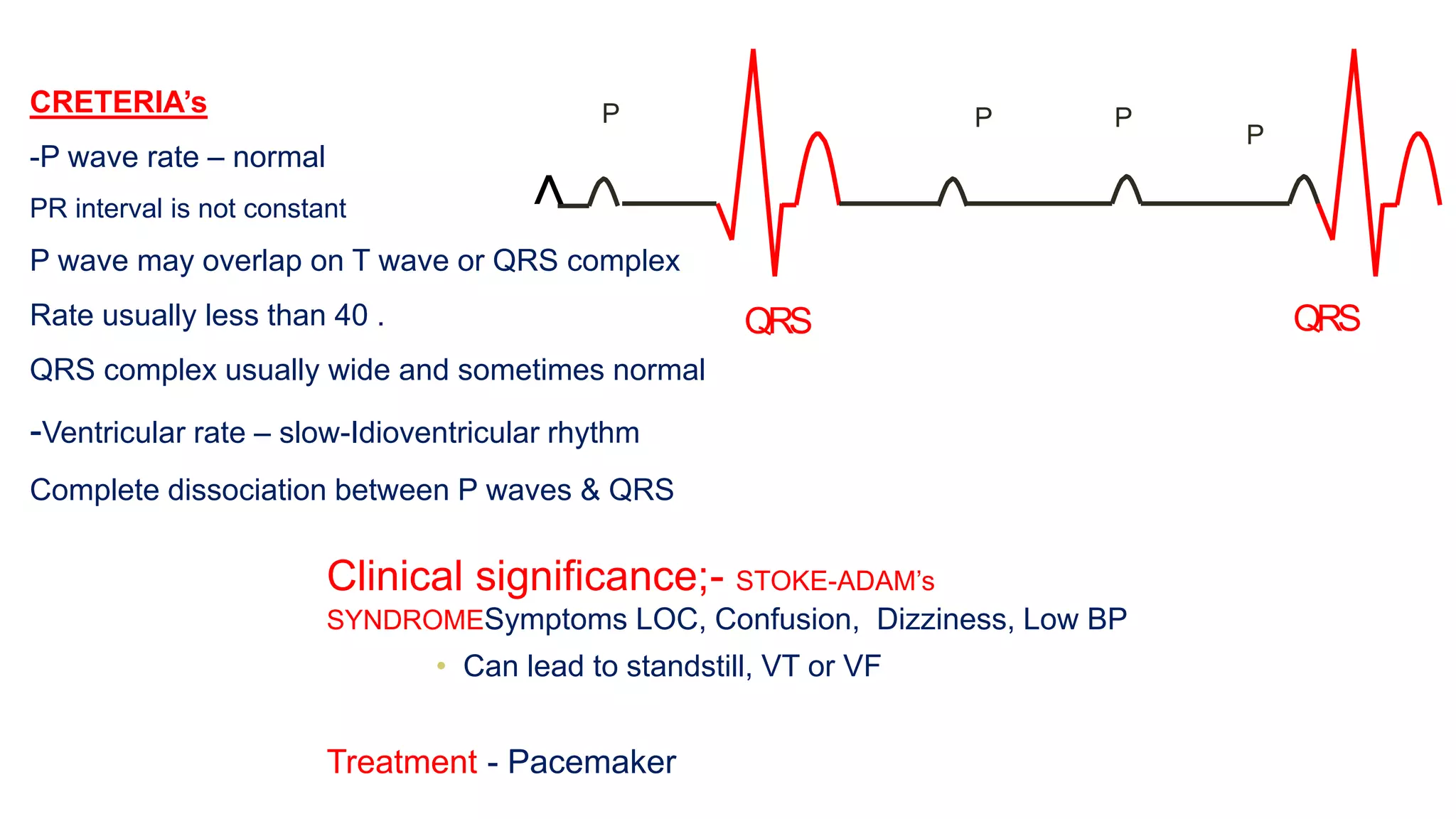 CARDIAC ARRTHYMIAs PART 2 BY DR. QAZI IMTIAZ RASOOL | PPT