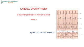 CARDIAC ARRTHYMIAs PART 2 BY DR. QAZI IMTIAZ RASOOL | PPT