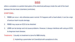 CARDIAC ARRTHYMIAs PART 2 BY DR. QAZI IMTIAZ RASOOL | PPT