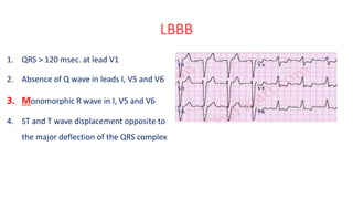 CARDIAC ARRTHYMIAs PART 2 BY DR. QAZI IMTIAZ RASOOL | PPT