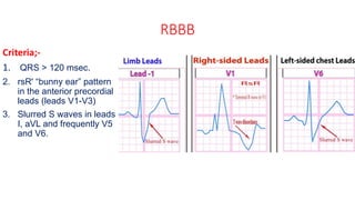 CARDIAC ARRTHYMIAs PART 2 BY DR. QAZI IMTIAZ RASOOL | PPT