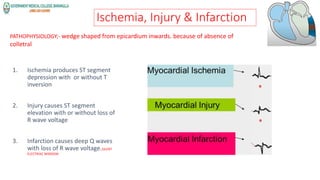 CARDIAC ARRTHYMIAs PART 2 BY DR. QAZI IMTIAZ RASOOL | PPT