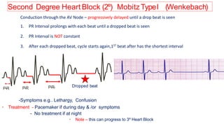 CARDIAC ARRTHYMIAs PART 2 BY DR. QAZI IMTIAZ RASOOL | PPT