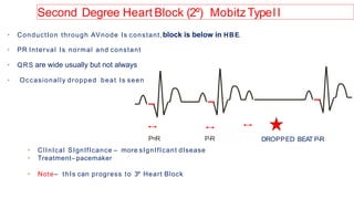 CARDIAC ARRTHYMIAs PART 2 BY DR. QAZI IMTIAZ RASOOL | PPT