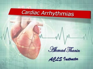 Cardiac arrhythmia | PPT