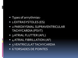 CARDIAC ARRYTHMIAS.ppt mbbs | PPT
