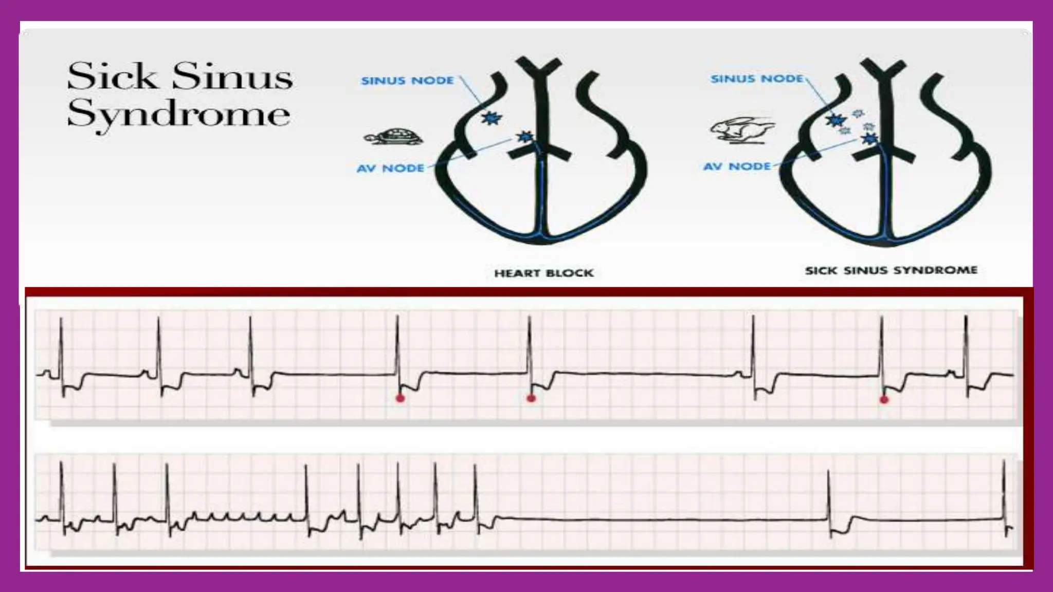 cardiac arrythmias .my presentation (1) - Copy.pptx