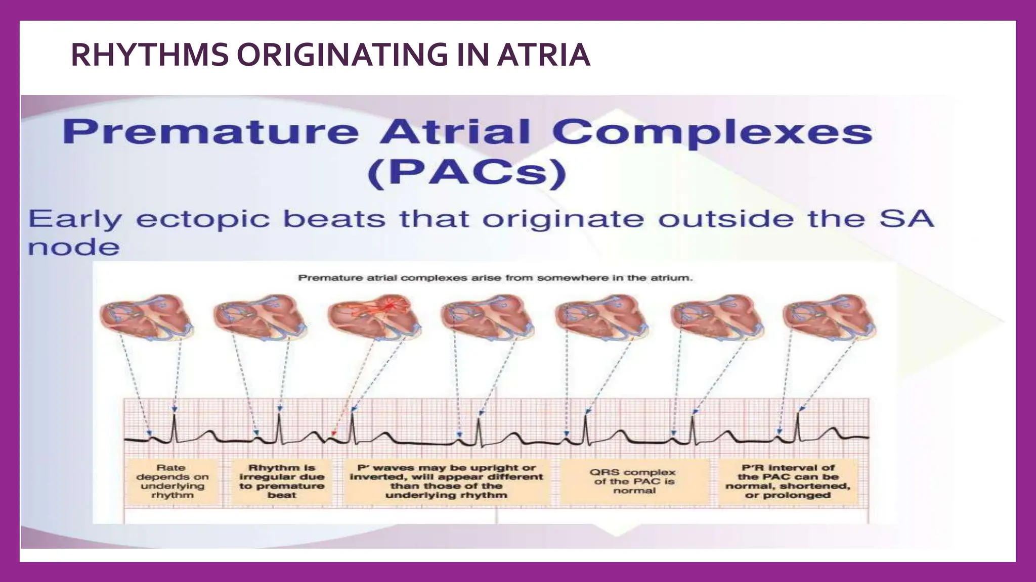 cardiac arrythmias .my presentation (1) - Copy.pptx