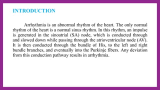 cardiac arrythmias .my presentation (1) - Copy.pptx