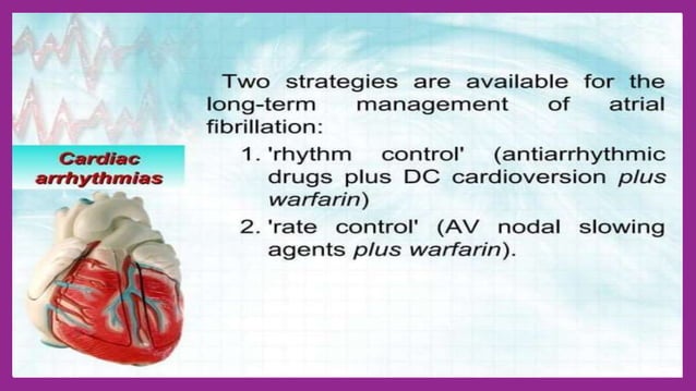 cardiac arrythmias .my presentation (1) - Copy.pptx
