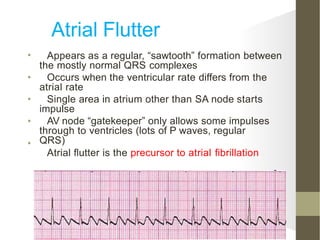 Cardiac arrythmias -biochemistryconverted.pptx