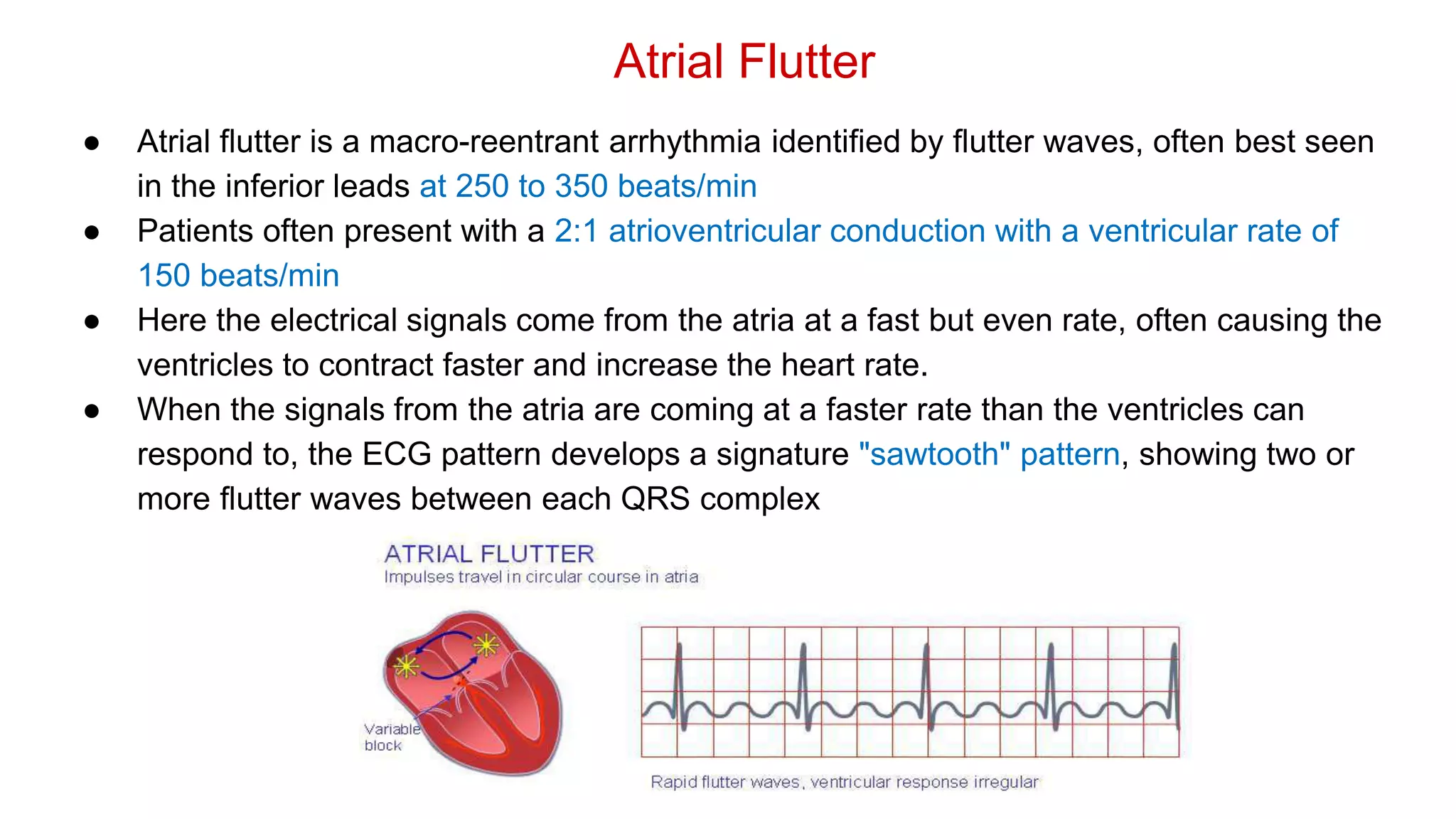 CARDIAC ARRYTHMIAS AND MANAGEMENT(1).pptx