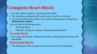 Cardiac Arrhythmias | PDF