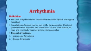Arrhythmia
