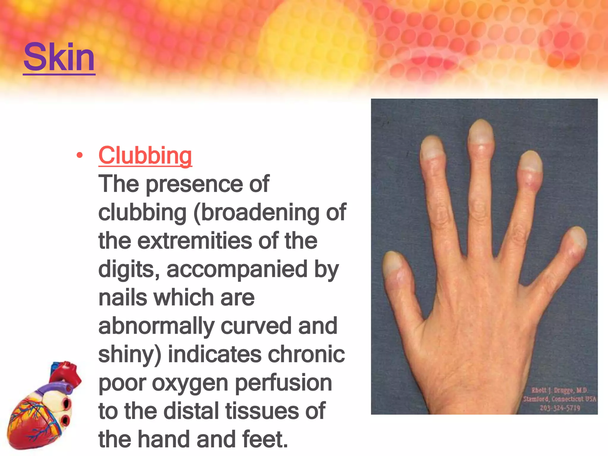 Cardiac assessment ppt | PPTX