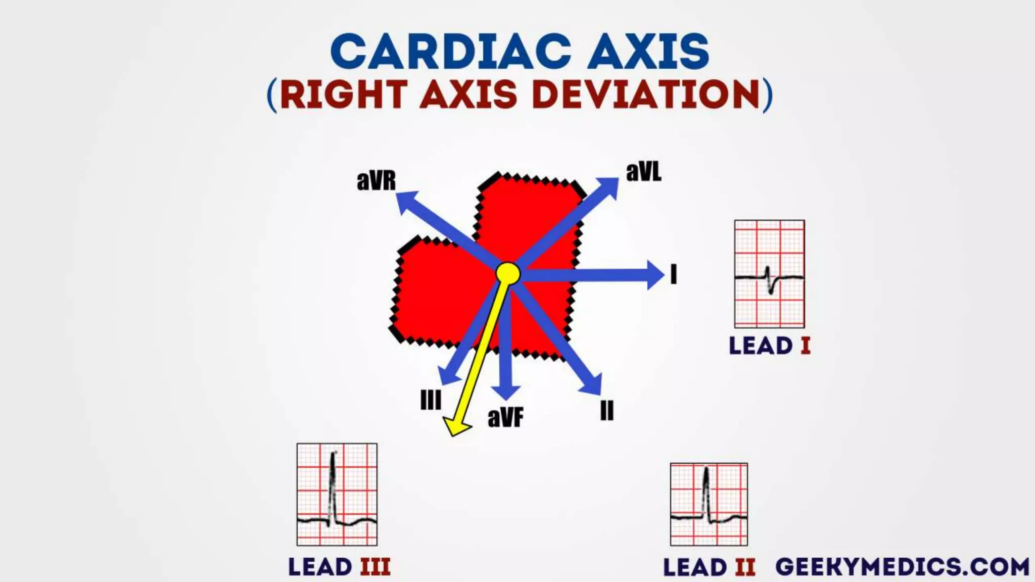 Cardiac axis | PPTX