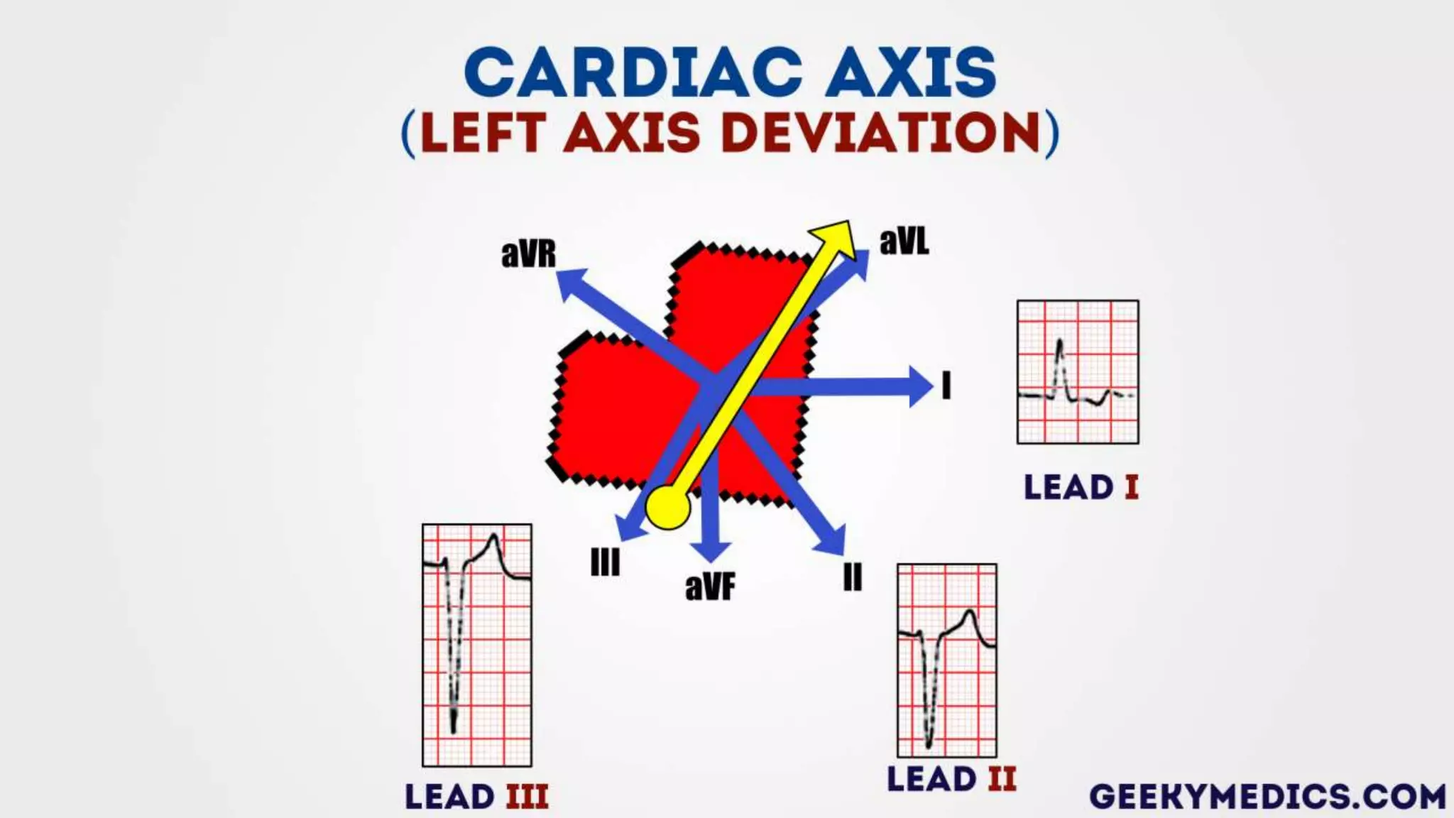 Cardiac axis | PPTX