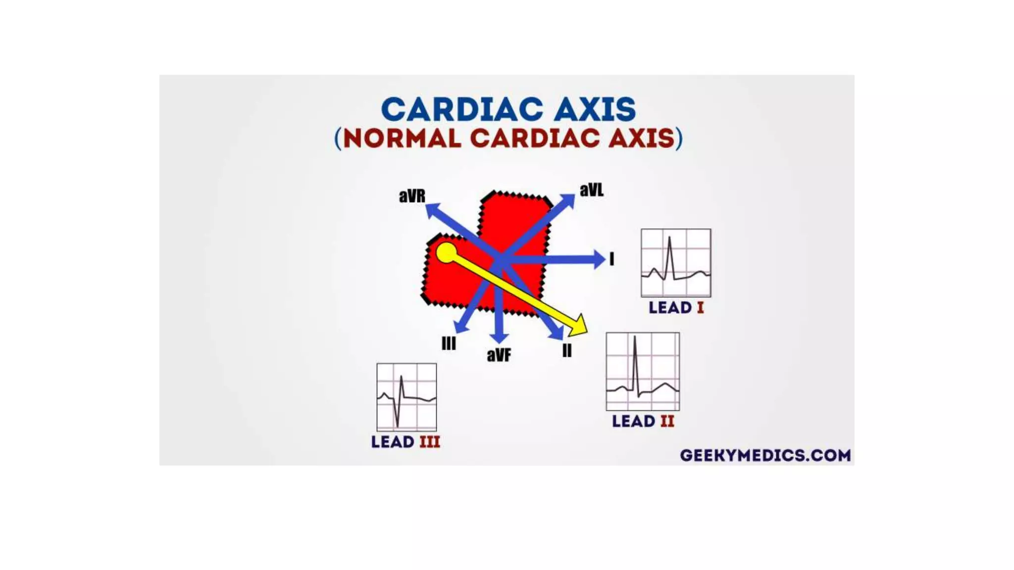 Cardiac axis | PPTX