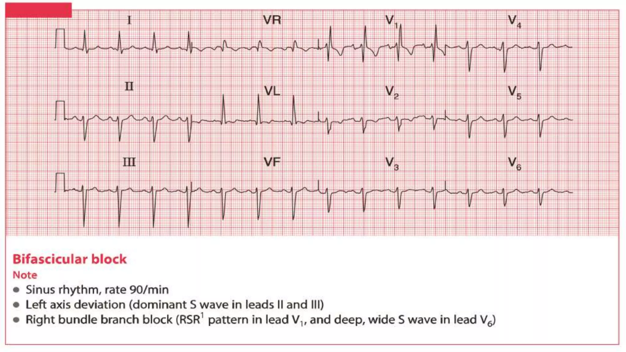 Cardiac Axis Simplified.pptx
