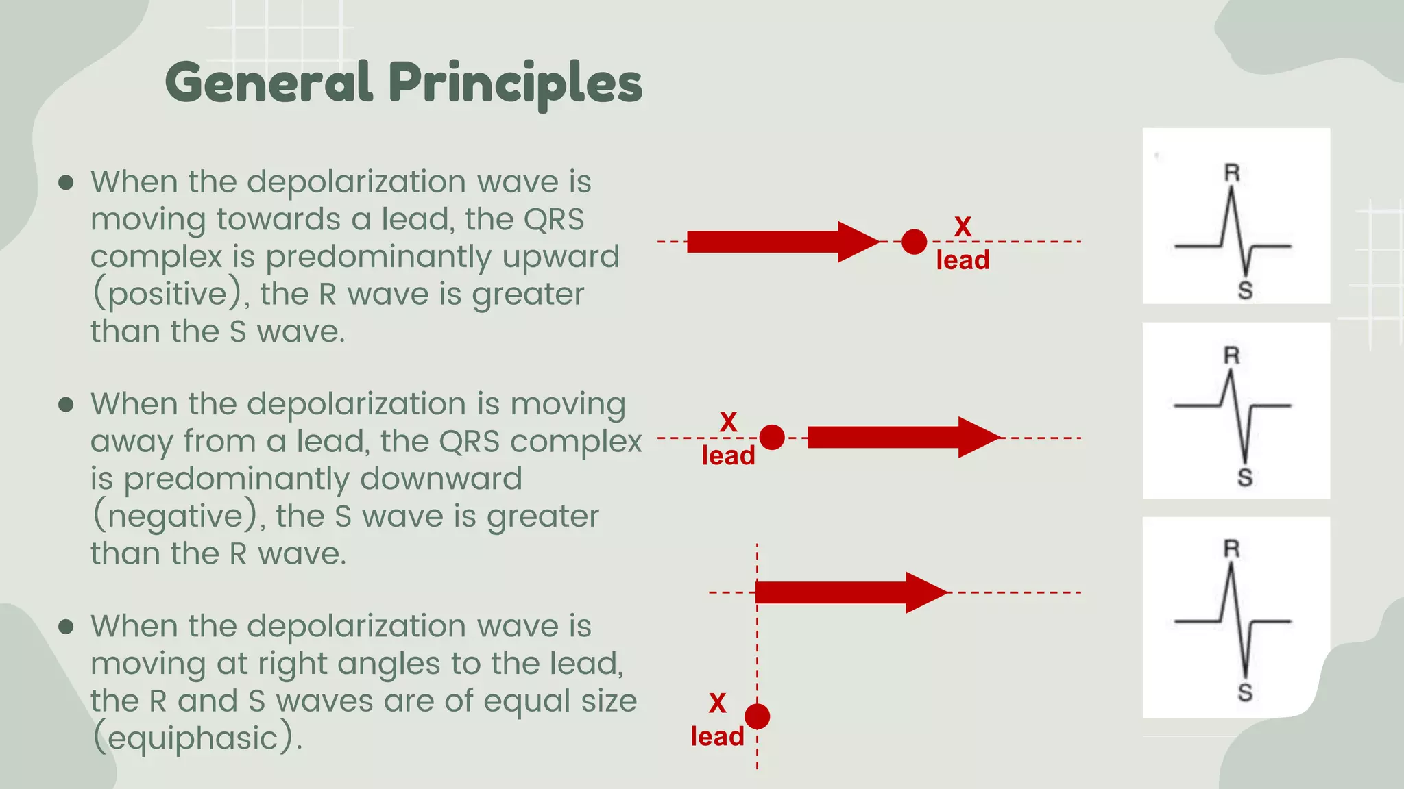 Cardiac Axis Simplified.pptx
