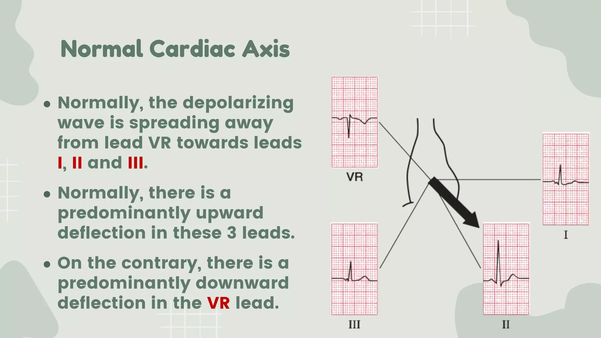 Cardiac Axis Simplified.pptx