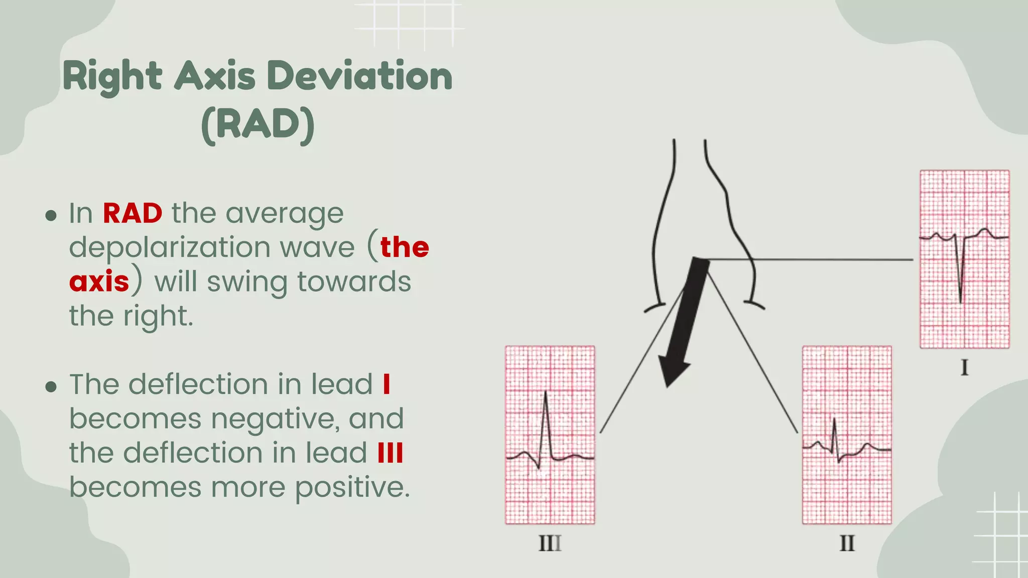 Cardiac Axis Simplified.pptx