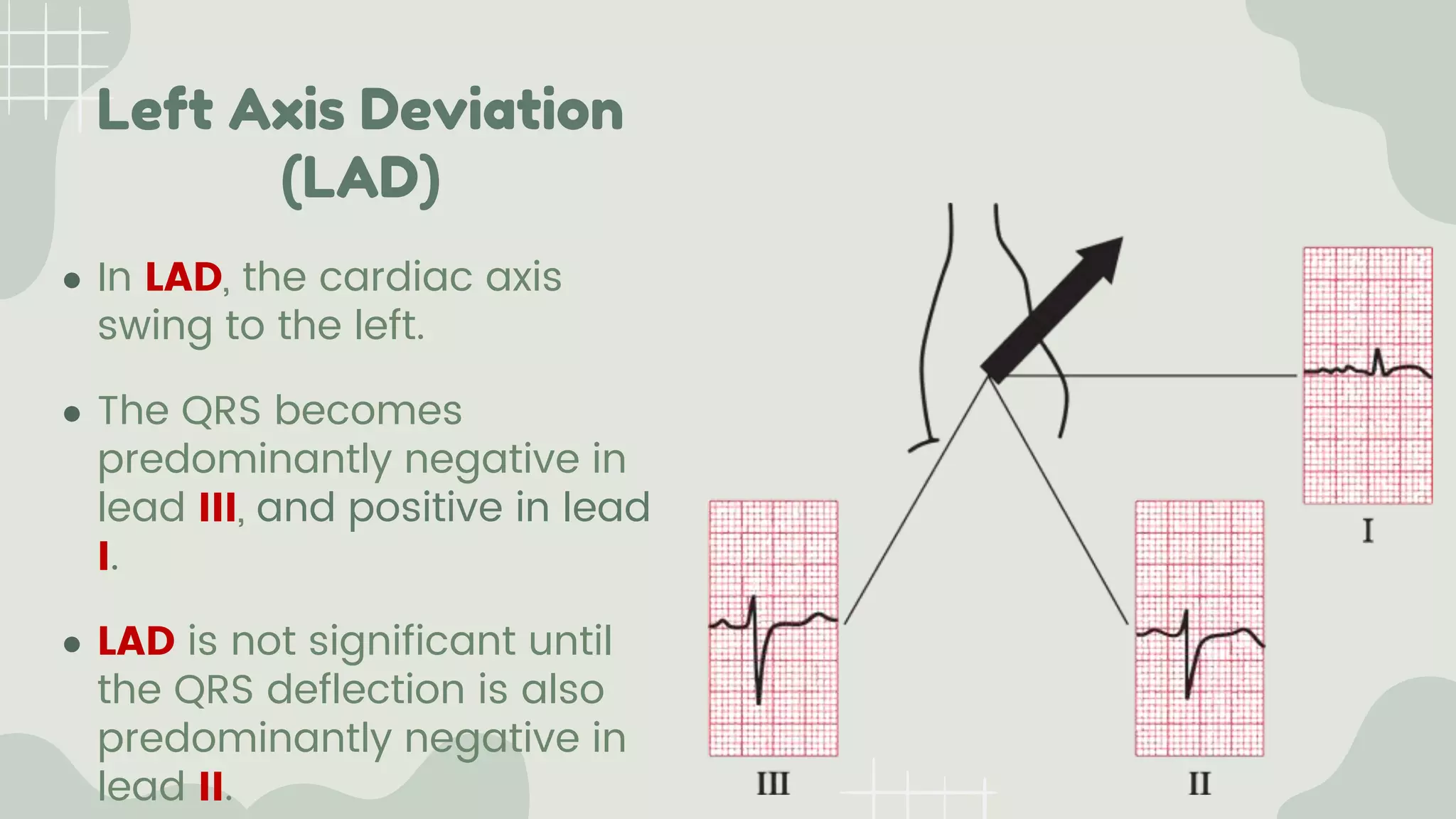 Cardiac Axis Simplified.pptx