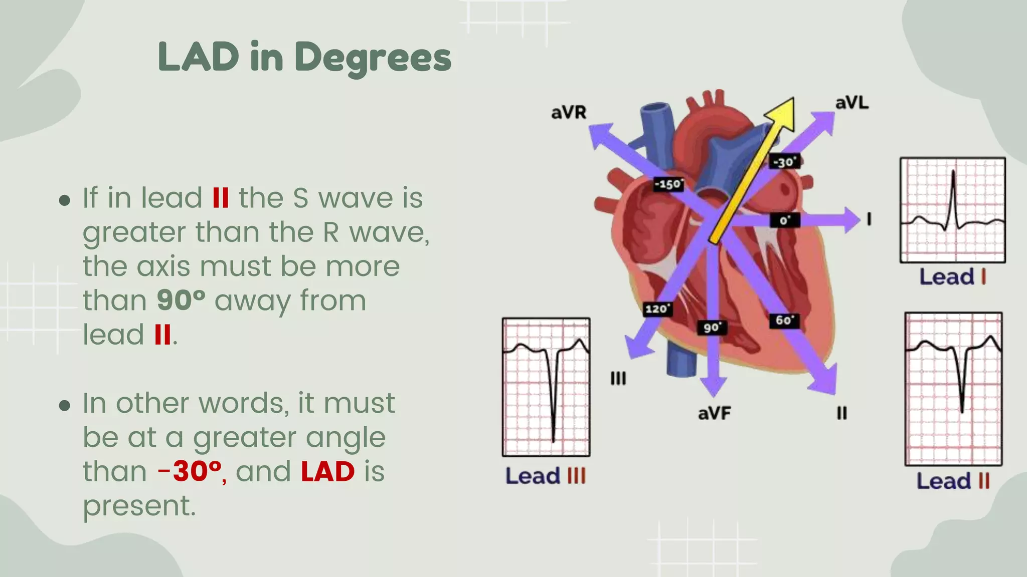 Cardiac Axis Simplified.pptx