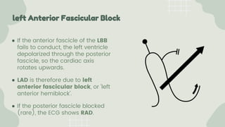 Cardiac Axis Simplified.pptx