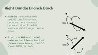 Cardiac Axis Simplified.pptx