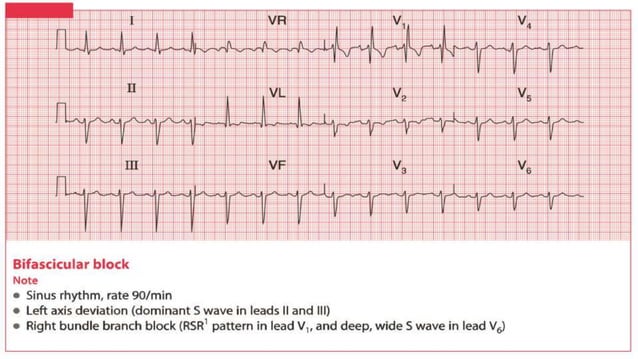Cardiac Axis Simplified.pptx