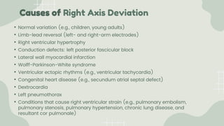 Cardiac Axis Simplified.pptx