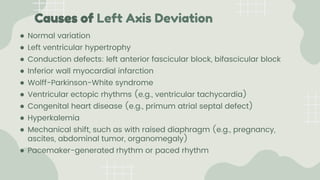 Cardiac Axis Simplified.pptx