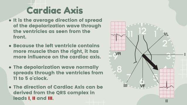 Cardiac Axis Simplified.pptx