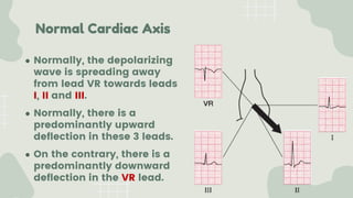 Cardiac Axis Simplified.pptx