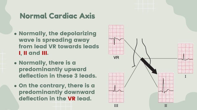 Cardiac Axis Simplified.pptx