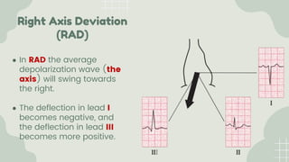 Cardiac Axis Simplified.pptx