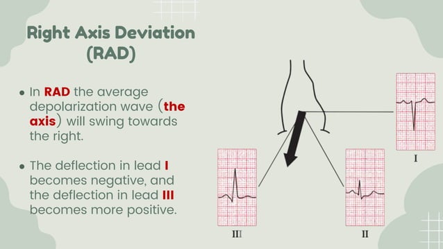 Cardiac Axis Simplified.pptx