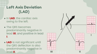 Cardiac Axis Simplified.pptx