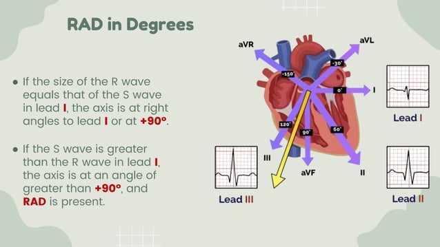 Cardiac Axis Simplified.pptx