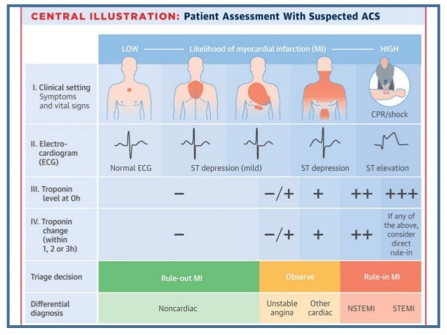 Cardiac biomarkers - II